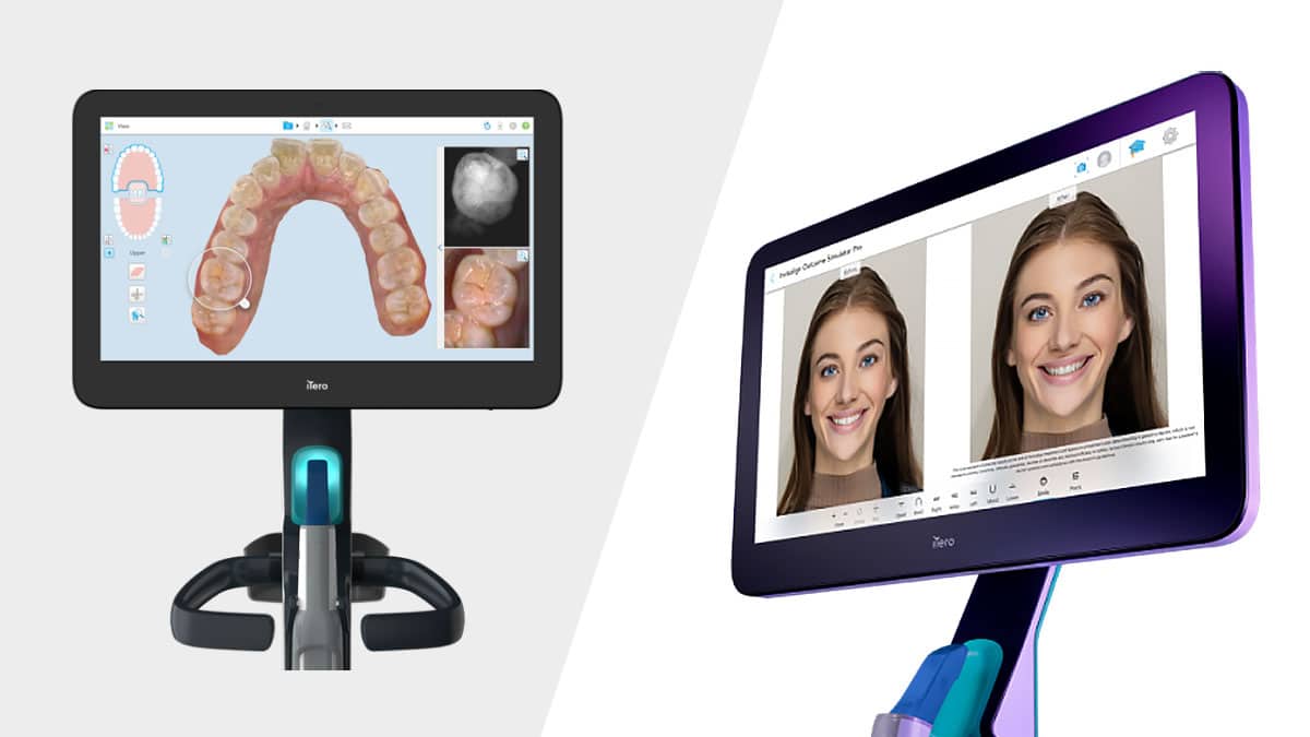 iTero Digital Scan in Lakewood | Advanced Dental Technology